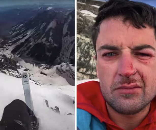 VIDEO. Matt Randall: le immagini della terrificante caduta con gli sci ...